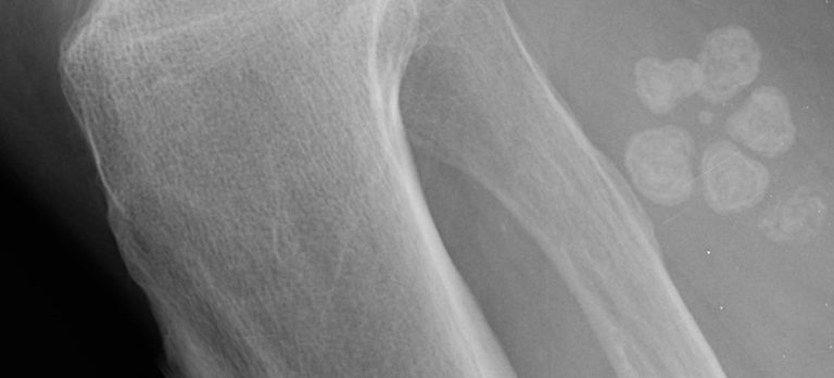 Incident at Devils Den | Terry Lovelace Incident at Devils Den | Radio ...